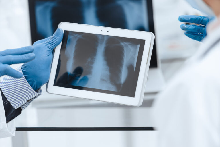 Digital X Rays: What They Are, How They Work, and Their Benefits ...